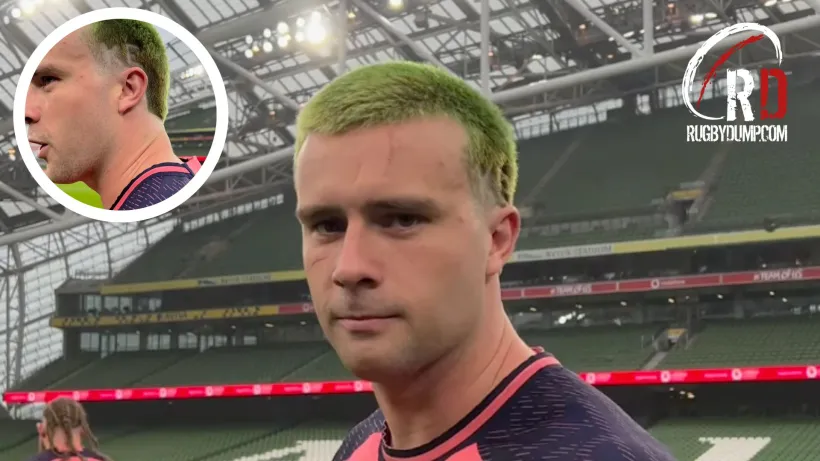 Ireland star Mack Hansen gets wild hair cut for England match | Rugbydump