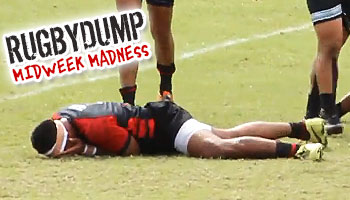 Worst Rugby Injuries