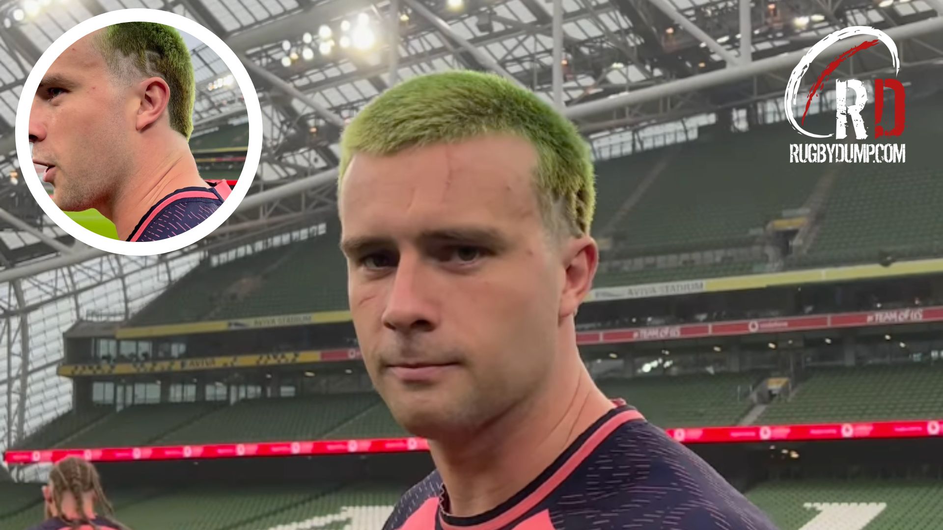 Ireland star Mack Hansen gets wild hair cut for England match | Rugbydump